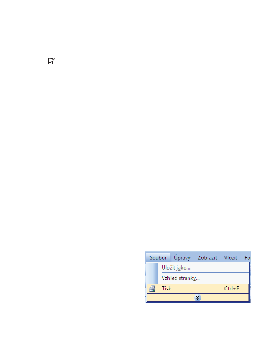 Výběr zásobníku papíru v systému Windows - HP LaserJet Pro 400 color ...